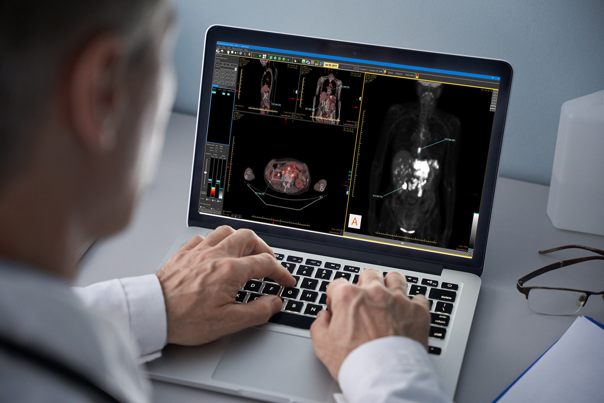 Convergent Imaging MRT Dosimetry Receives 510(k) Clearance - Convergent Imaging Solutions