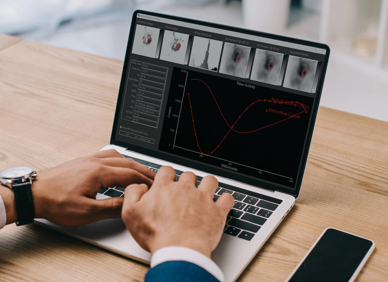 UniSyn MI™ Nuclear Medicine Software | Convergent Imaging