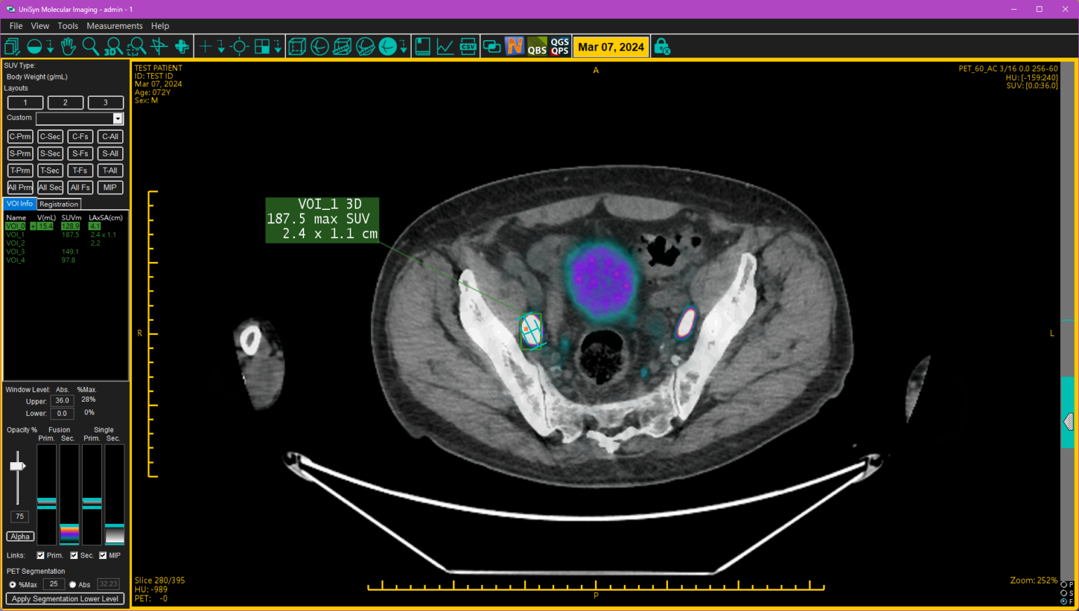 Essential Measurements - Convergent Imaging Solutions