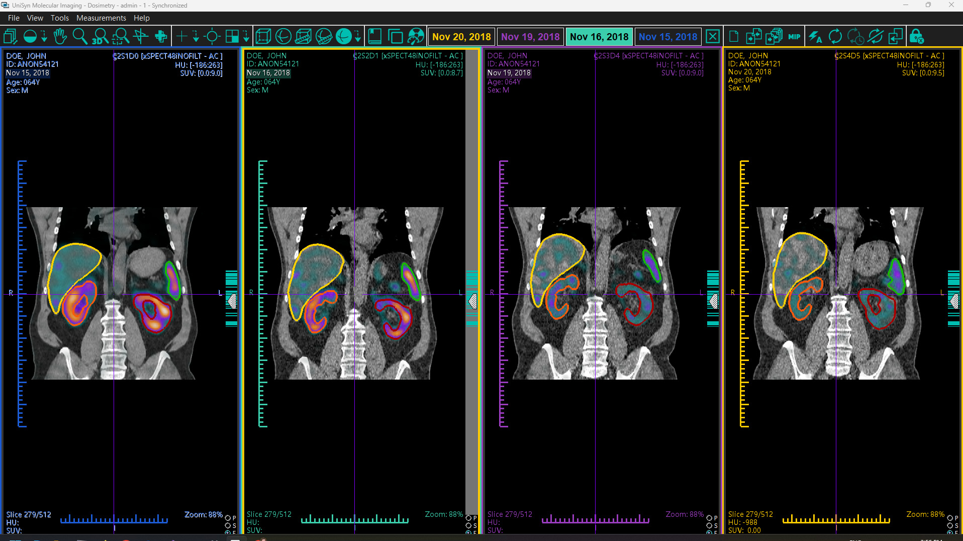Theranostics - Convergent Imaging Solutions